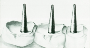 Prof. Dr. Albert Gerber – Condylator.com